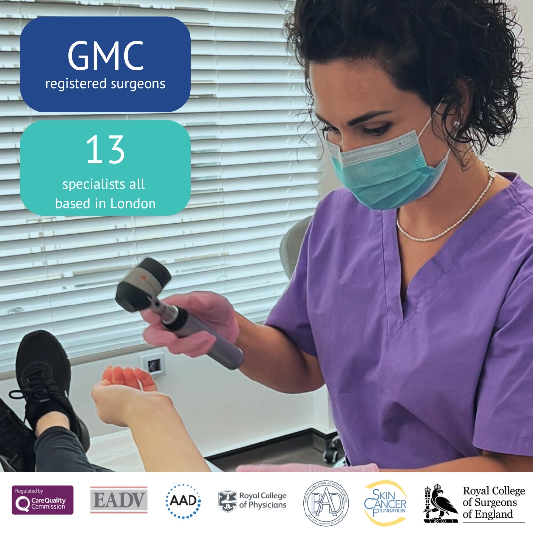 Cyst Removal in London (Same Day - £295) - City Dermatology Clinic